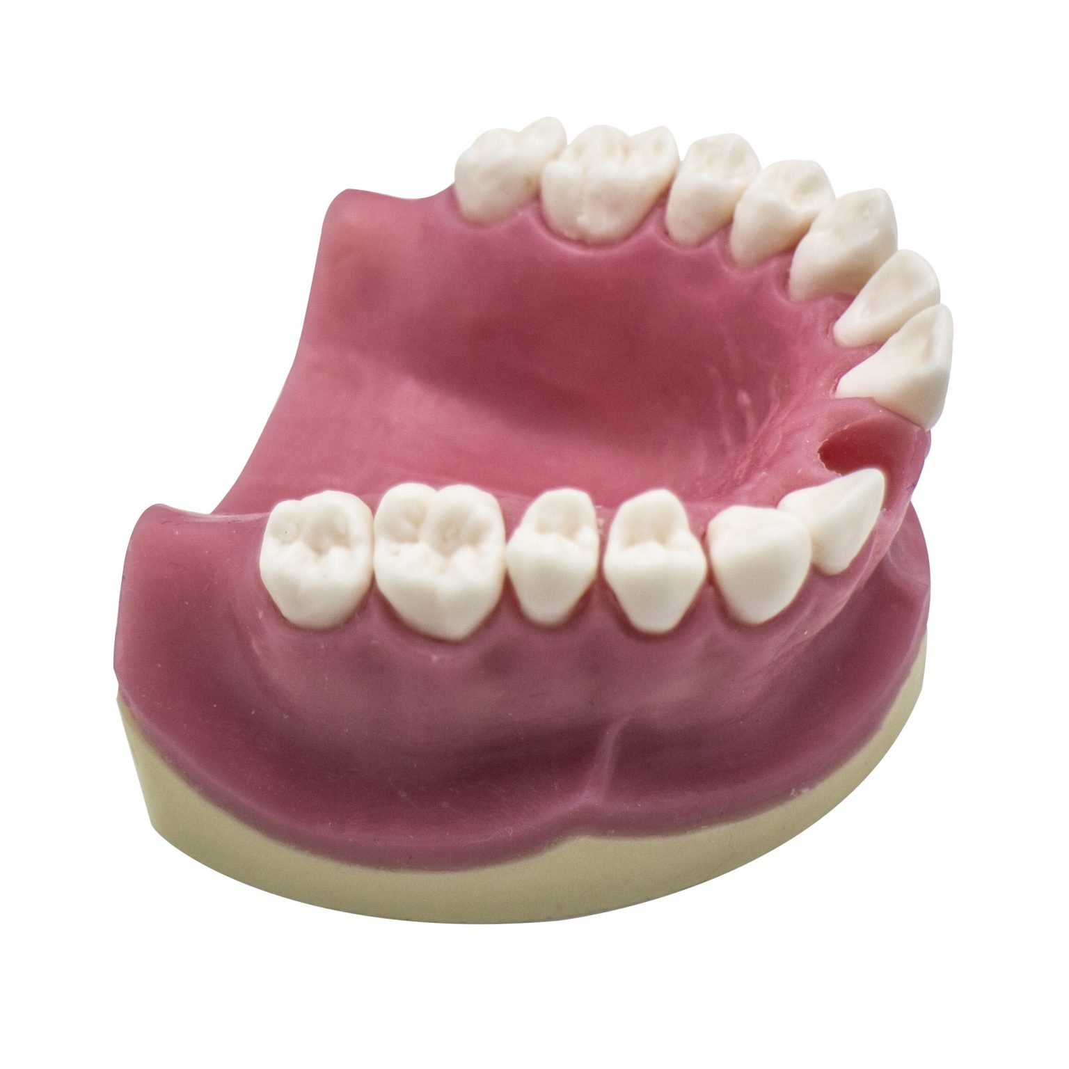 Dental Implant Model – Jojenmodel-dental model teeth,dental simulation ...