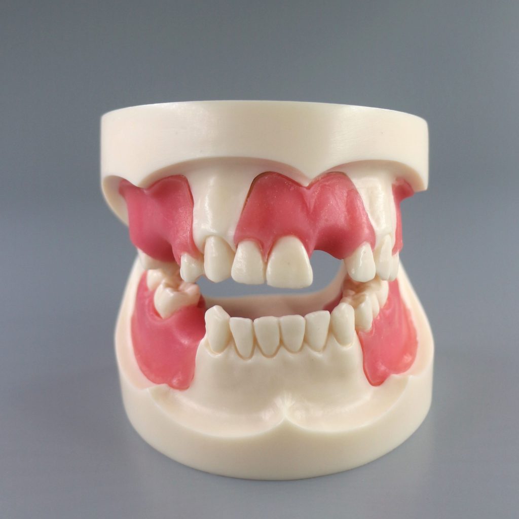 Orthodontic training Typodont – Jojenmodel-dental model teeth,dental ...