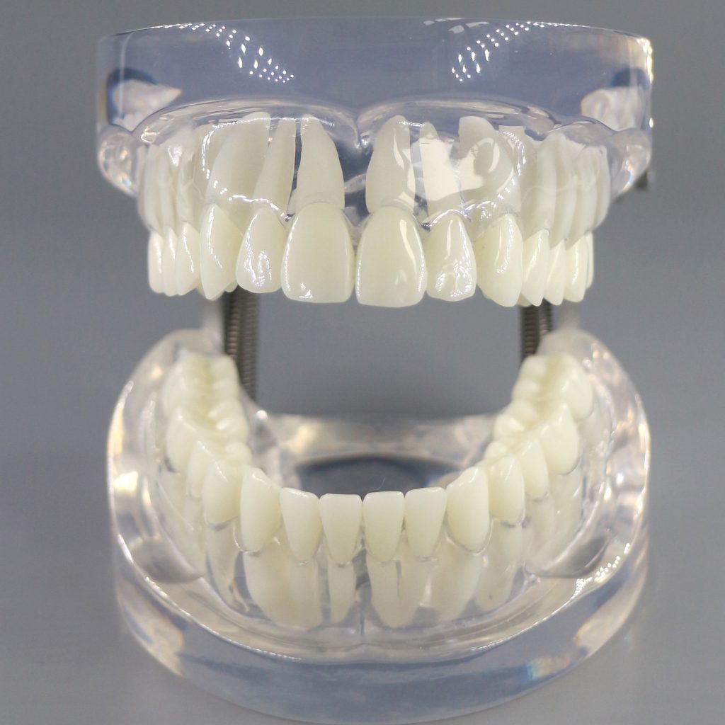 Patient education model – Jojenmodel-dental model teeth,dental ...