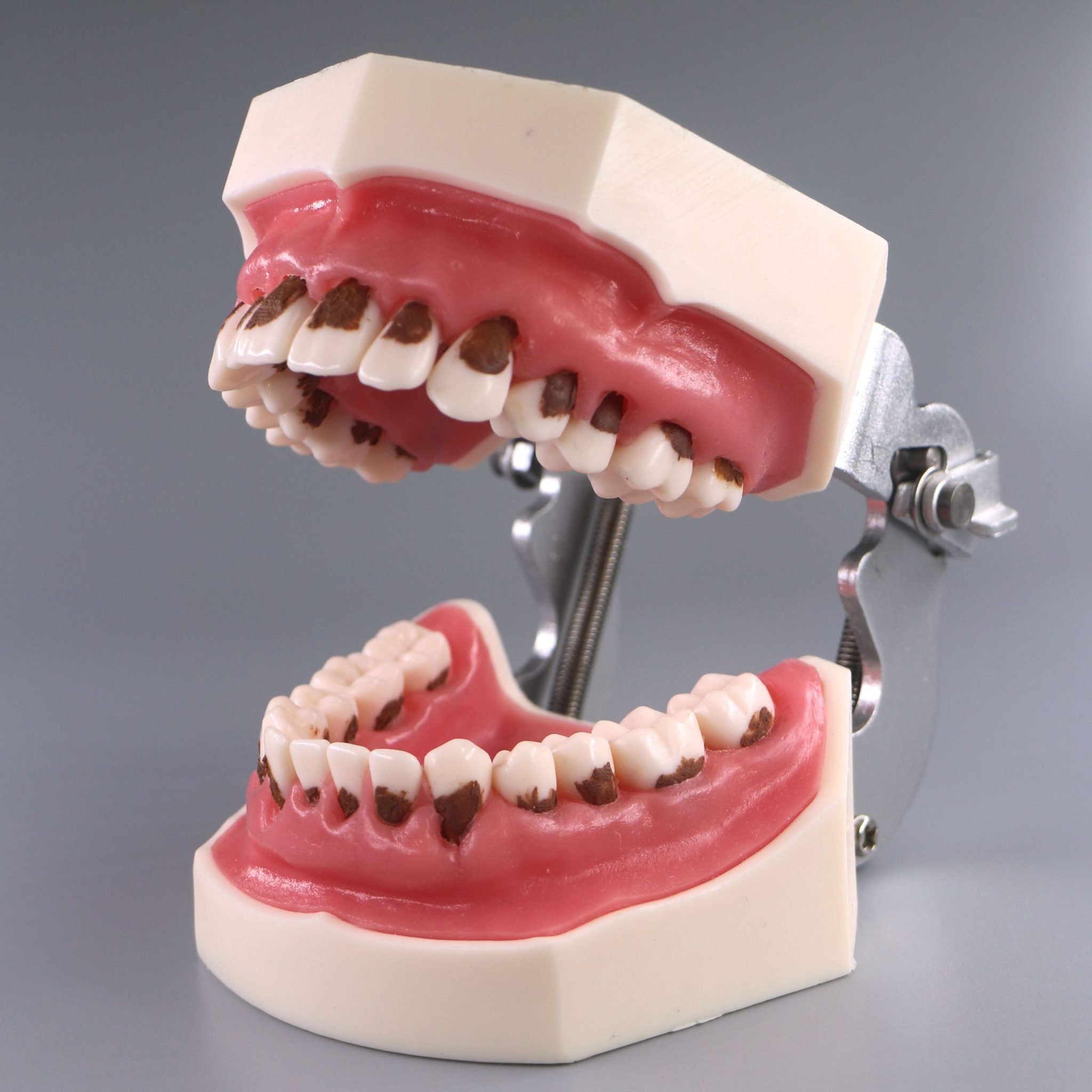 Periodontal Jaw Model – Jojenmodel-dental model teeth,dental simulation ...