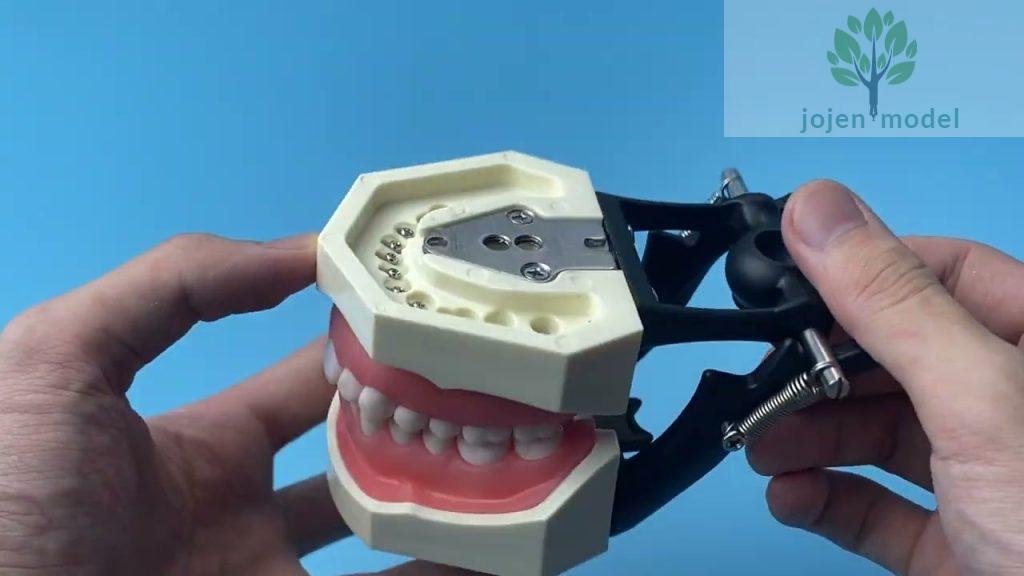 Demo bridge dental models Cheap Manufacturer Chinese,Periodontal Models ...