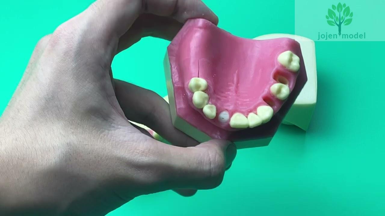 dental model China Best Company,Demo dental models,dental teeth model ...