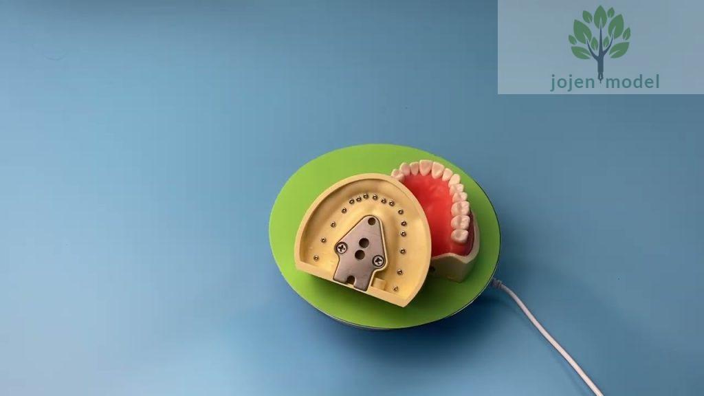 implant practice model,How to use Dental Implant Model,dental implant ...
