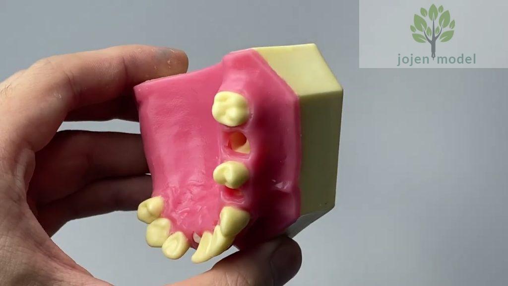 implant model dental,Special Tooth Models affordable,dental education ...
