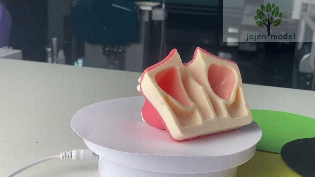 models before and after wisdom teeth removal,Typodont Teeth Cheap ...