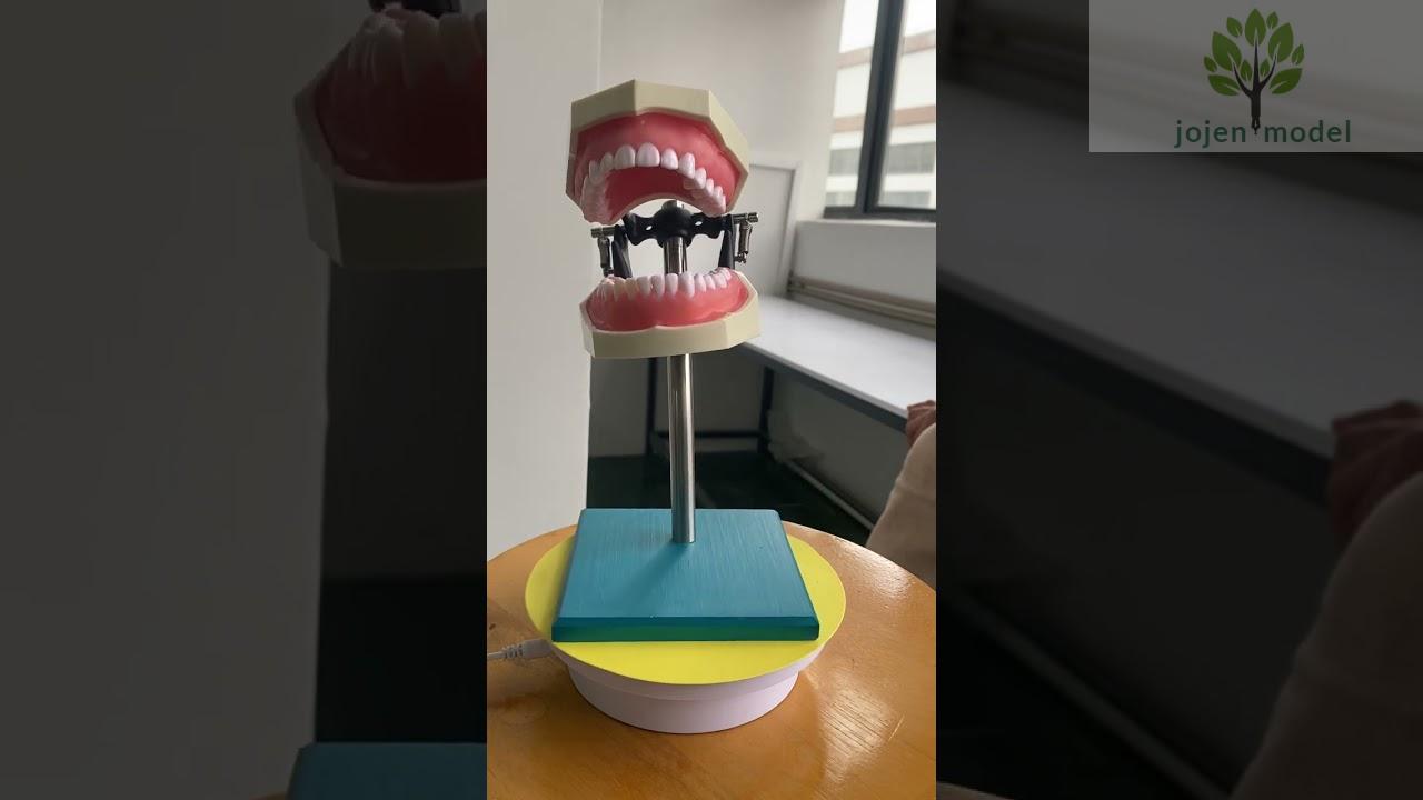 Educational Model for Implant Denture,dental implant practice models ...