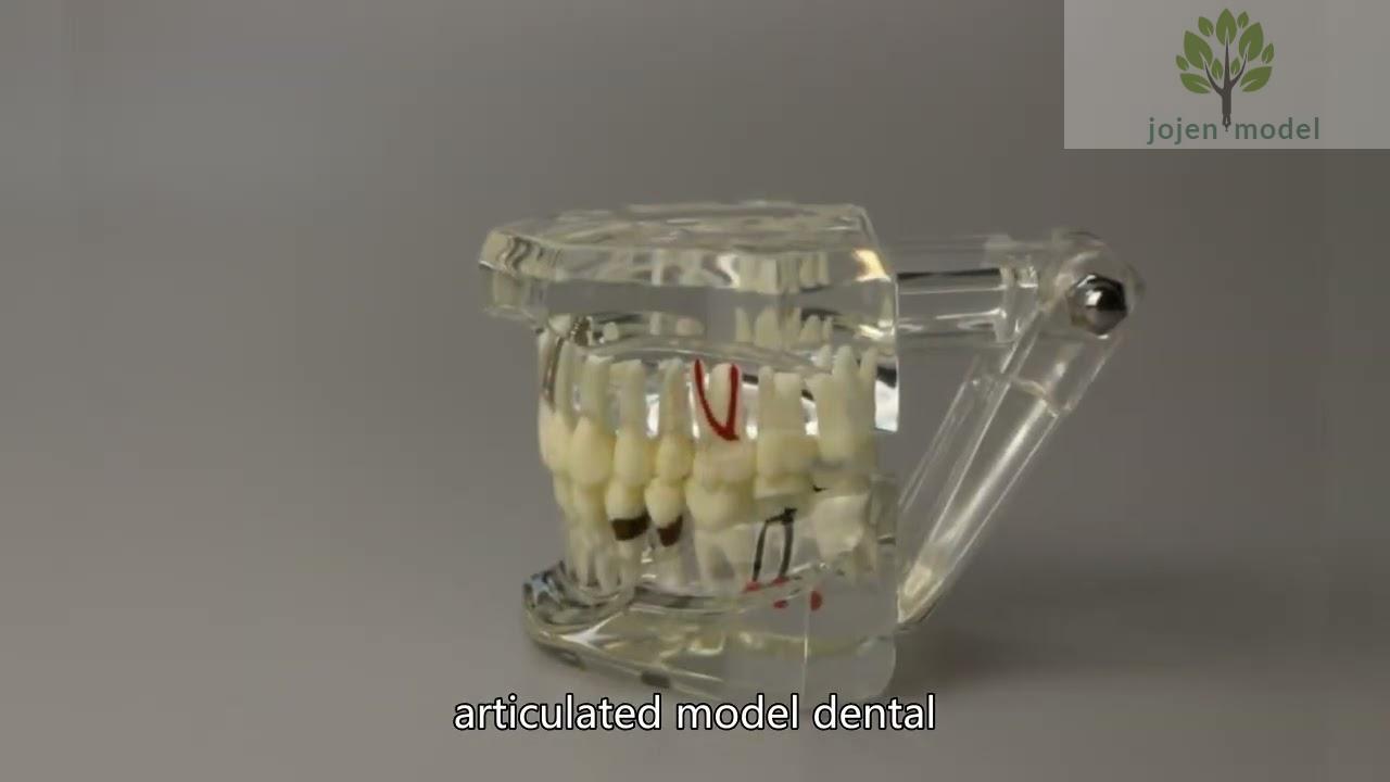 Educational Model for Implant Denture,dental implant practice models ...