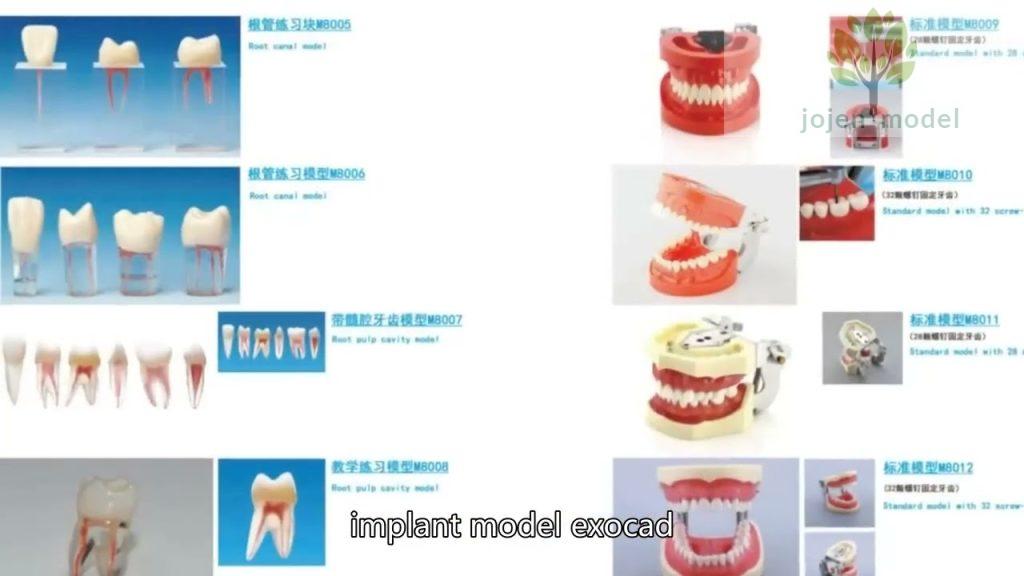 patient education model dental China wholesaler,Implant Practice Jaw ...