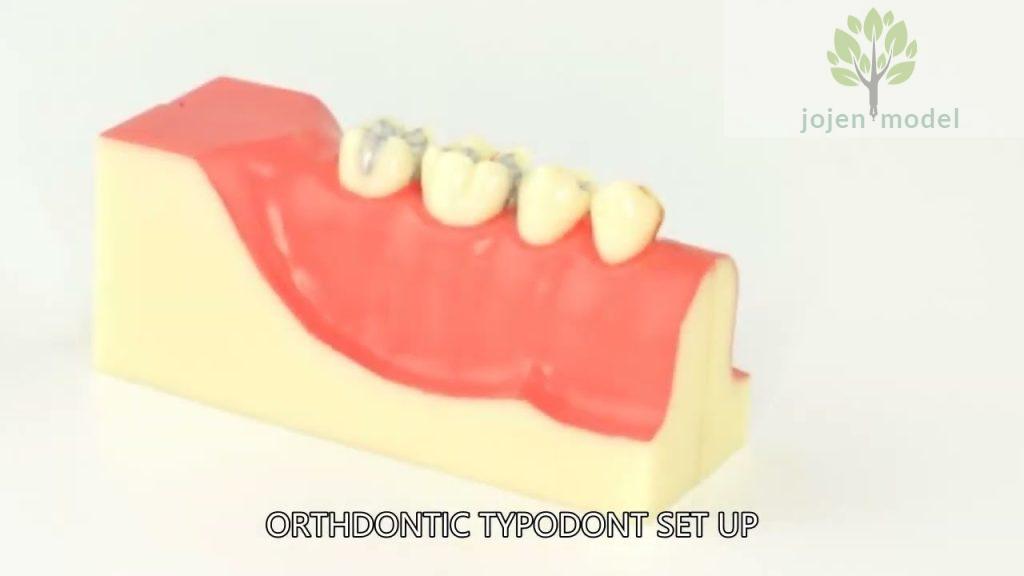 dental typodont jaw set china manufacturer,six implants overdenture ...